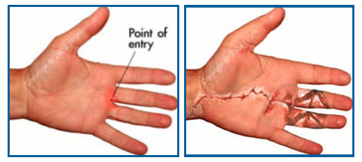 Hydraulic hose hazards and safety | Ideagen Plant Assessor